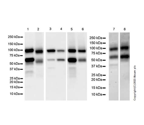 Complement Factor B重组抗体 Epr27443 6 Complement Factor B抗体ab309149