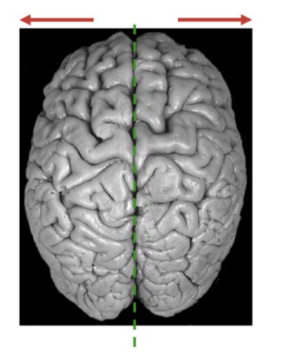Brain And Behaviour Module Flashcards Quizlet