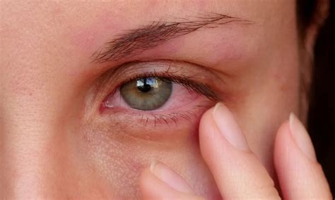 Eye Injections For Long Beach Ca Apex Retina Institute