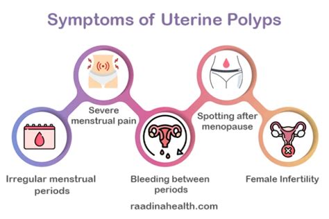 Uterine Polyps Endometrial Polyp Causes Symptoms Mayo Clinic Q And A