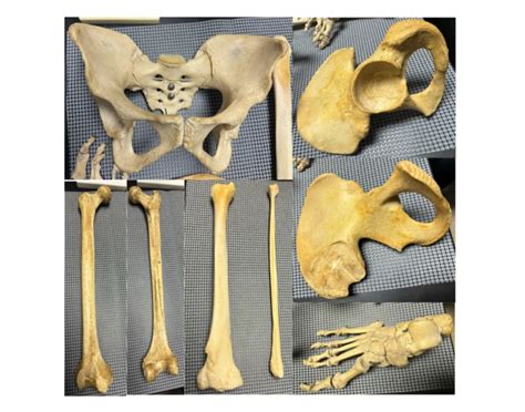 Lower Appendicular Diagram Quiz
