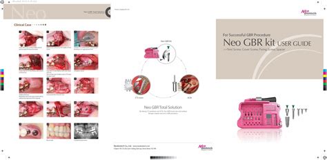 Pdf Gbr Kit User Guide Dokumen Tips