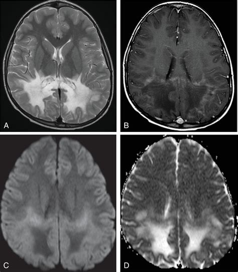 Inherited And Acquired Metabolic Disorders Clinical Tree
