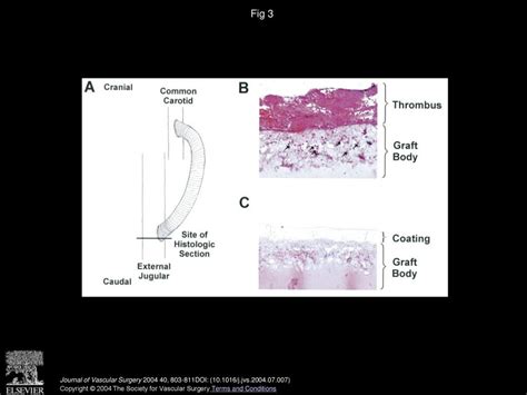 Nitric Oxidereleasing Biopolymers Inhibit Thrombus Formation In A
