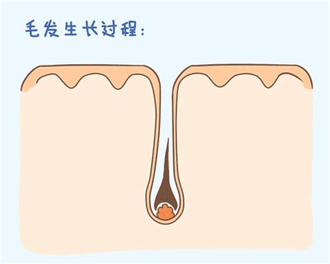 为什么有些头发掉了，就再也长不出来了？