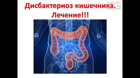 Дисбактериоз кишечника у женщин симптомы и лечение что делать питание