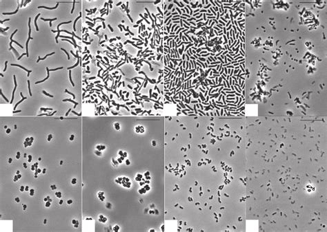 Vegetative A C E G And Cyst Like Cell Dormant B D F H Forms Of