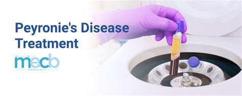 Peyronies Disease Treatment Male Enhancement Center Bangkok