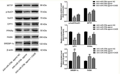 SREBP1 Antibody Affinity Biosciences