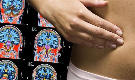 Dementia Risk Factors May Include Abdominal Aortic Calcification Warns