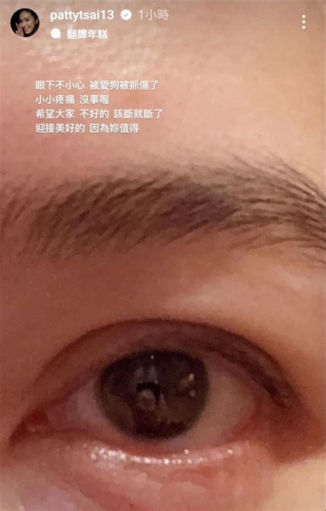 連勝文妻子怎麼了？蔡依珊突po傷勢照 喊「該斷就斷」又秒刪
