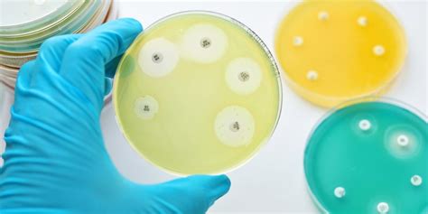 Researchers Uncover First Steps Driving Antibiotic Resistance Clinicallab