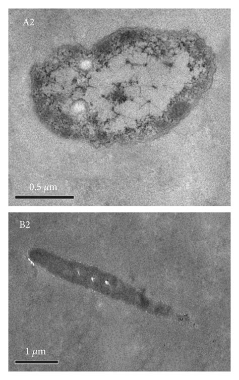 Transmission Electron Micrographs Of P Fluorescens A And S