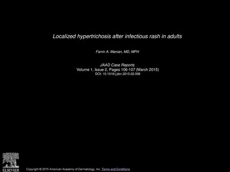 Localized Hypertrichosis After Infectious Rash In Adults Ppt Download