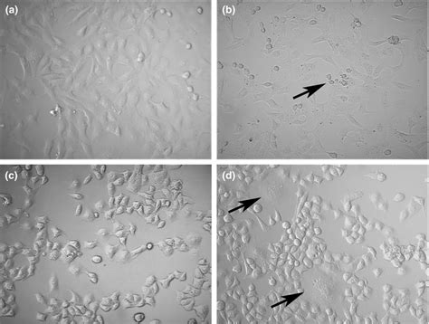 Cytopathic Effect Of Newcastle Disease Virus Ndv Abu Ghraib2017