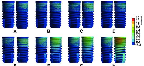 Stress Patterns On Implants In The Unilateral Bite A Ball Attachment Download Scientific