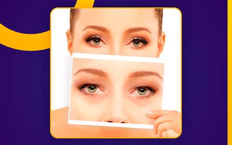 O que é blefaroplastia superior Blog da SBCPO