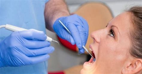 8 Easy Methods For Dental Calculus Removal At Home Guide [year]
