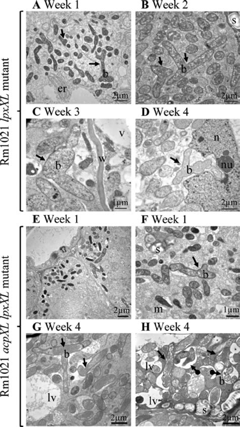 Bacteroid Abnormalities For The S Meliloti Lpxxl Single Mutant And Download Scientific Diagram
