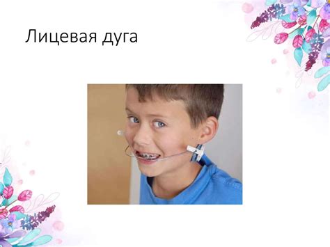 Виды ортодонтических аппаратов для коррекции зубочелюстных аномалий ...