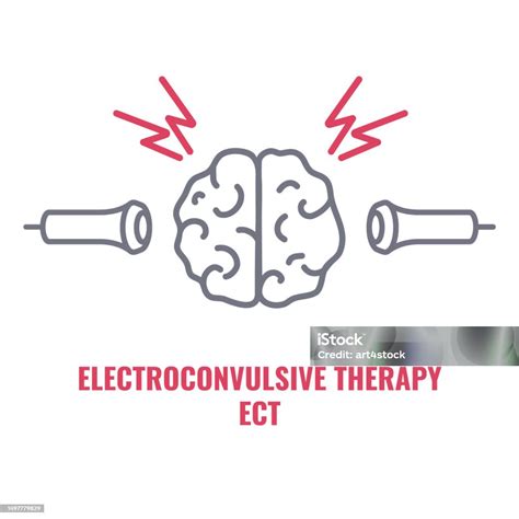 Ect Electroconvulsive Therapy For Severe Depression Treatment Stock