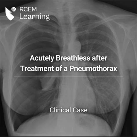 Rcemlearning New A Female With A Spontaneous Facebook