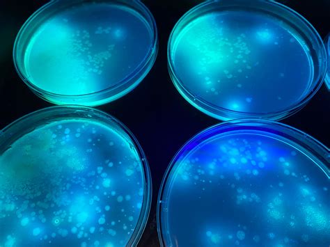 Pseudomonas Aeruginosa On Cetrimide Agar Under Uv Light Rmicrobiology
