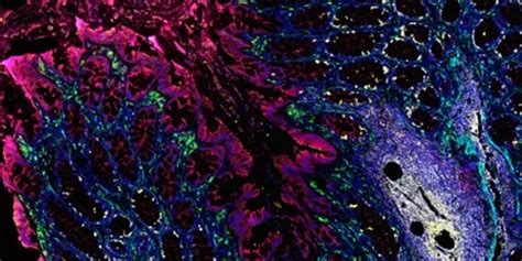 The New Echo® Ms System From Sciex Couples Ultra Fast Sampling