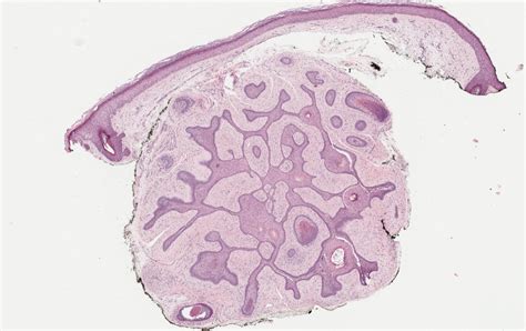 Differential Diagnosis In Dermatopathology 2014