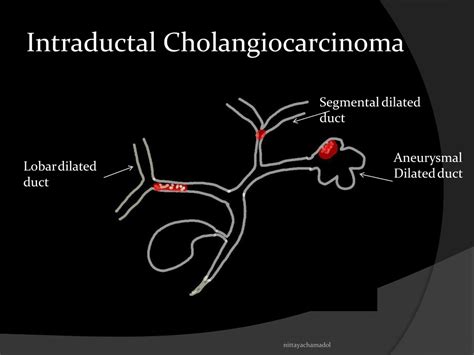 Ppt Ni T T A Y A Cham A Do L Md Radiolo G Ist Department Of Radiology