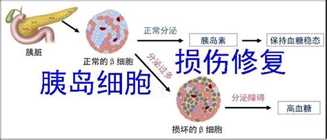 胰岛免疫损伤修复 玉米多糖 知乎