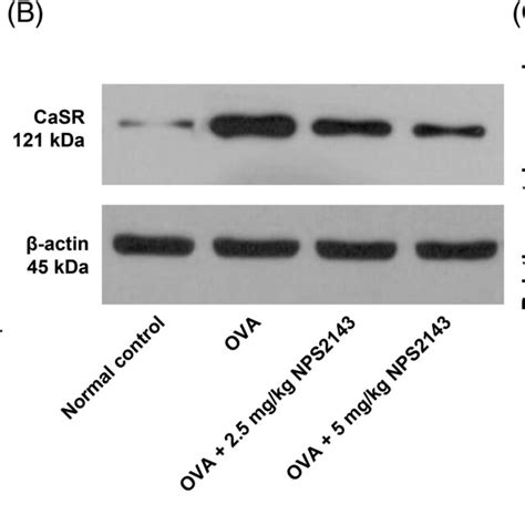 Comparison Of Calcium‐sensitive Receptor Casr Expression In The Lung