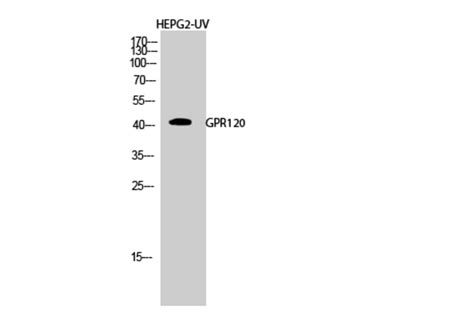 Anti Gpr120 Antibody A39231