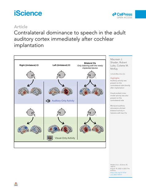 Pdf Contralateral Dominance To Speech In The Adult Auditory Cortex
