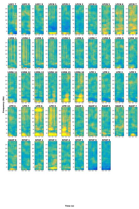 Multitaper Spectrogram Plot IEEG Pipelines 0 1 Documentation