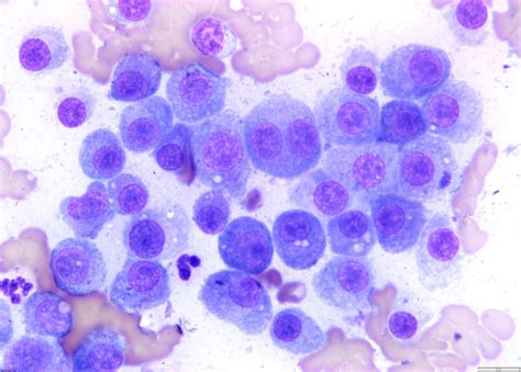 Hemangiosarcoma In Cats