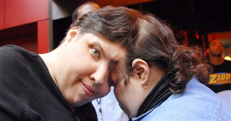 Worlds Oldest Conjoined Twins Lori And George Schappell Die At Age 62