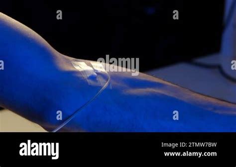 Vein Injection Stock Videos And Footage Hd And 4k Video Clips Alamy