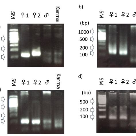Electrophoresis Image Obtained Using The Method Of Griffiths Et Al Download Scientific Diagram