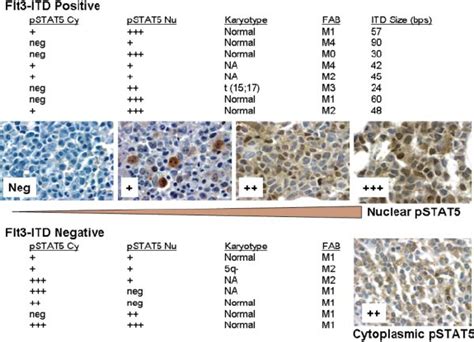 Relationship Between Flt3 Itd Status And Distribution Of Phospho Stat5 Download Scientific