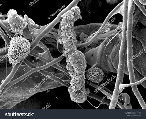 Microscopy รายการ ภาพ ภาพสตอกและเวกเตอร Shutterstock