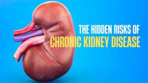 What Is A Comprehensive Metabolic Panel CMP Walk In Lab