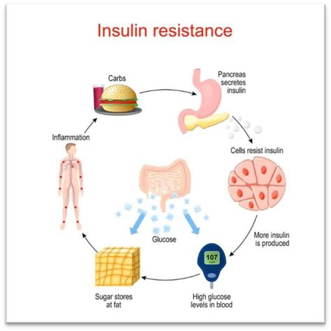 Carbohydrate Insulin Model Becky Dorner And Associates