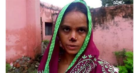 Мъж отхапа носа на жена си