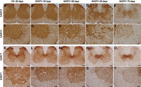 Expression Of Als‐linked Tdp‐43 Mutant In Astrocytes Causes Non‐cell‐autonomous Motor Neuron
