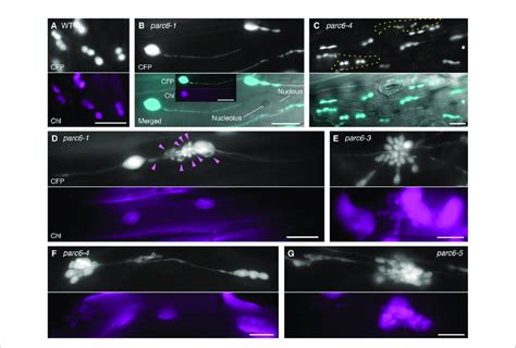 Morphology Of Plastids In Leaf Epidermal Pavement Cells Of Parc6
