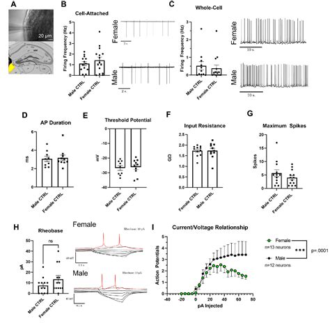 Figure 1 From Neuronal Excitability In The Medial Habenula And Ventral