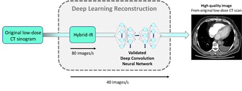 Figure 2 From Deep Learning Versus Iterative Reconstruction For Ct Pulmonary Angiography In The