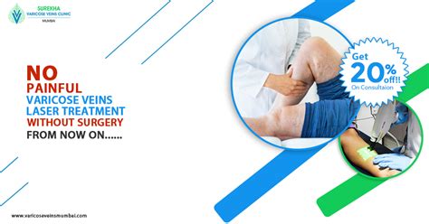Varicose Veins Spider Veins Treatment In Thane Ulhas Nagar Surekha