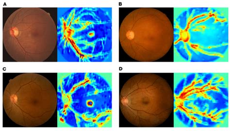 saliency maps of the deep learning models visual explanation of the